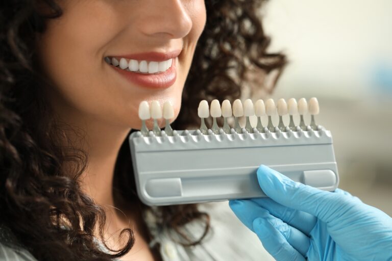 Porcelain vs. Composite Veneers — Which Is Right for You? | Shield ...